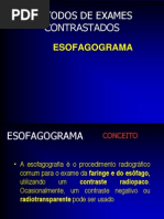 Exame de Esofagografia com Contraste | PDF | Vômito | Esôfago
