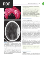 SAH, SDH, EDH: Key Differences Explained | PDF | Diseases And Disorders ...