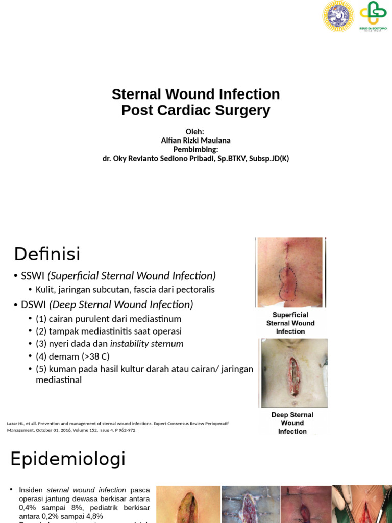 Sternal Wound Infection | PDF