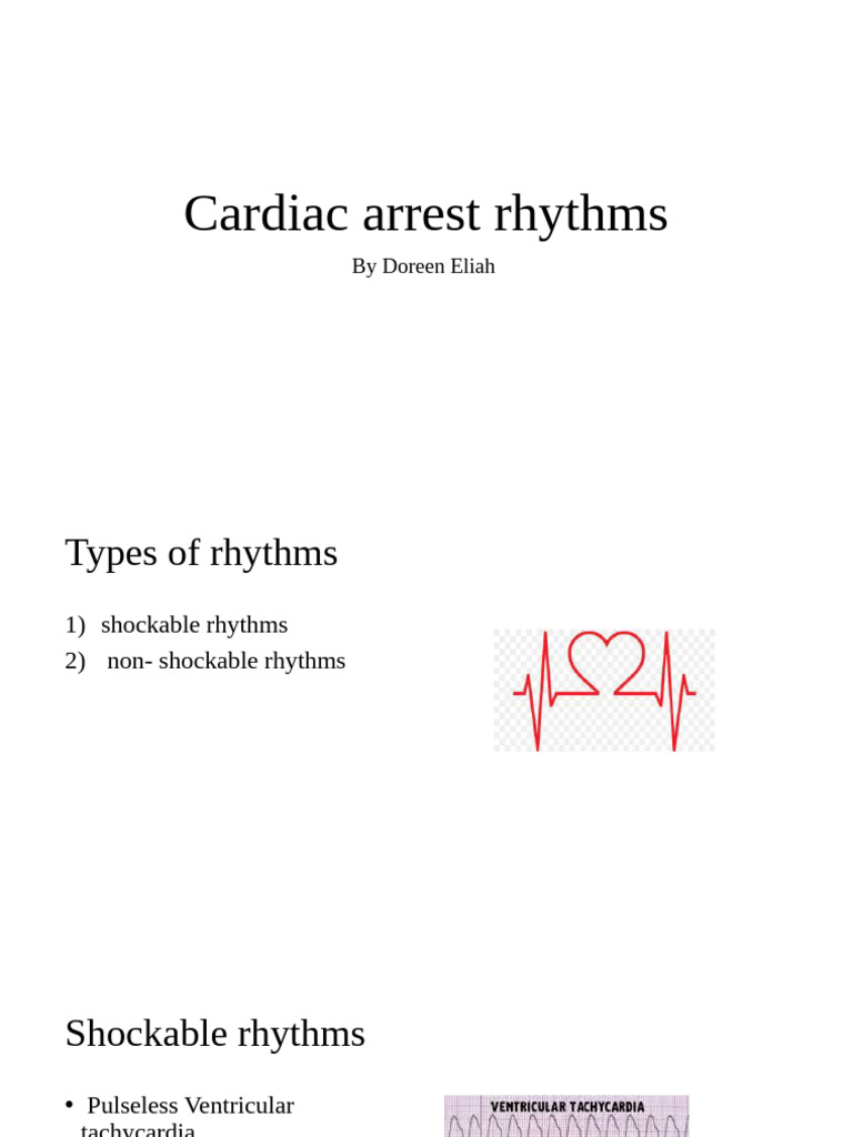 Cardiac Arrest Rythms | PDF
