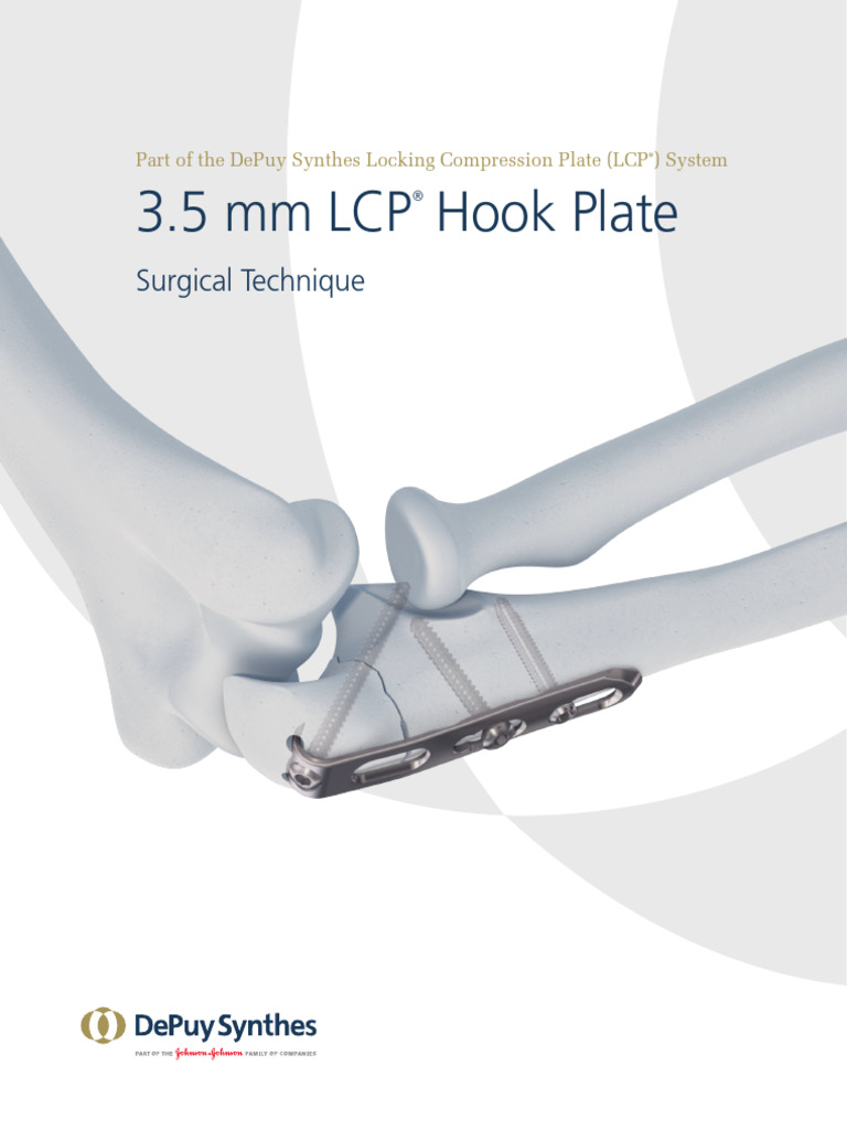 3.5 mm LCP Hook Plate Surgical Guide | PDF | Screw | Drill