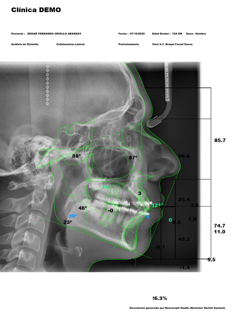 Cef Con RX | PDF