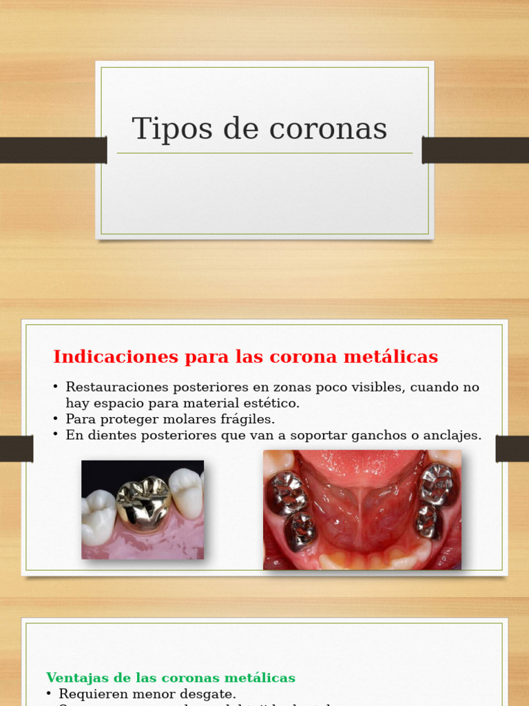 Tipos de coronas dentales y sus características | PDF
