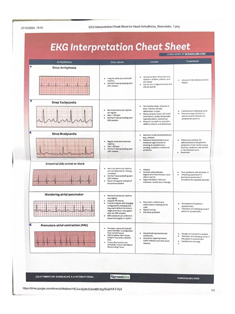 EKG Interpretation Cheat Sheet | PDF