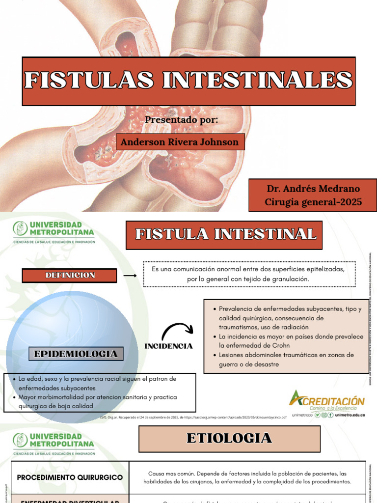 Fistula Intestinal | PDF | Enfermedad de Crohn | Tracto gastrointestinal