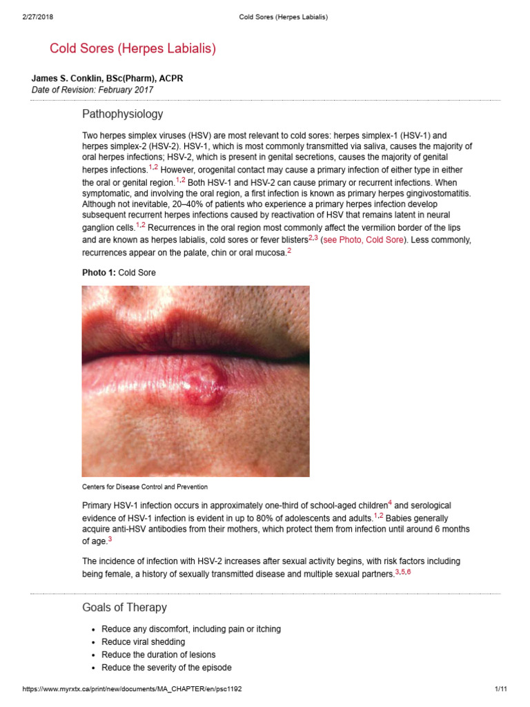 Cold Sores (Herpes Labialis) | PDF | Analgesic | Medical Specialties