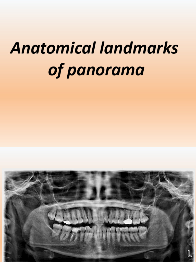 Panorama Anatomy and Errors | PDF | Human Nose | Tongue