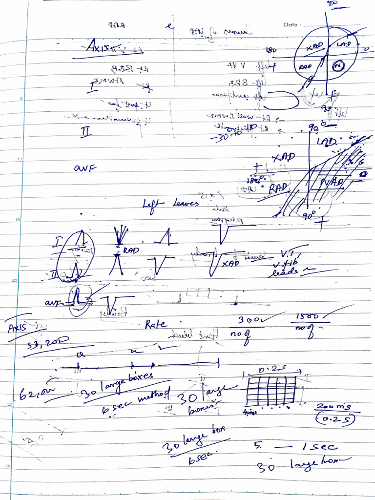 ECG Anupama Ma'Am | PDF