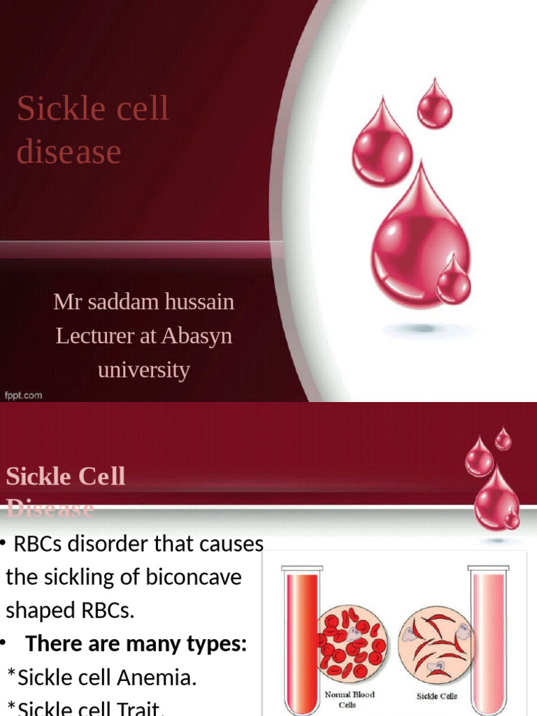 2 Sickle Cell Anemia | PDF | Blood | Tissue (Biology)