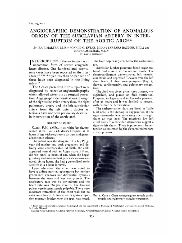 Angiographic Demonstration of Anomalous Origin of The Subclavian Artery ...