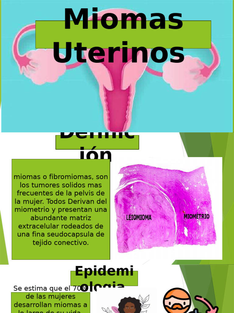 Miomas Uterinos: Clasificación y Tratamiento | PDF | Útero | El embarazo
