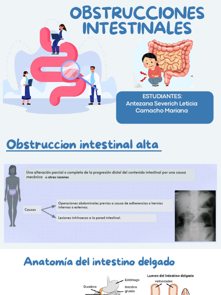 Obstrucciones Intestinales 20250704 184826 0000 | PDF | Intestino ...