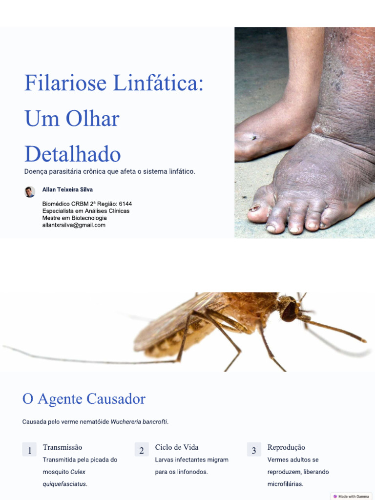 Filariose Linfática | PDF