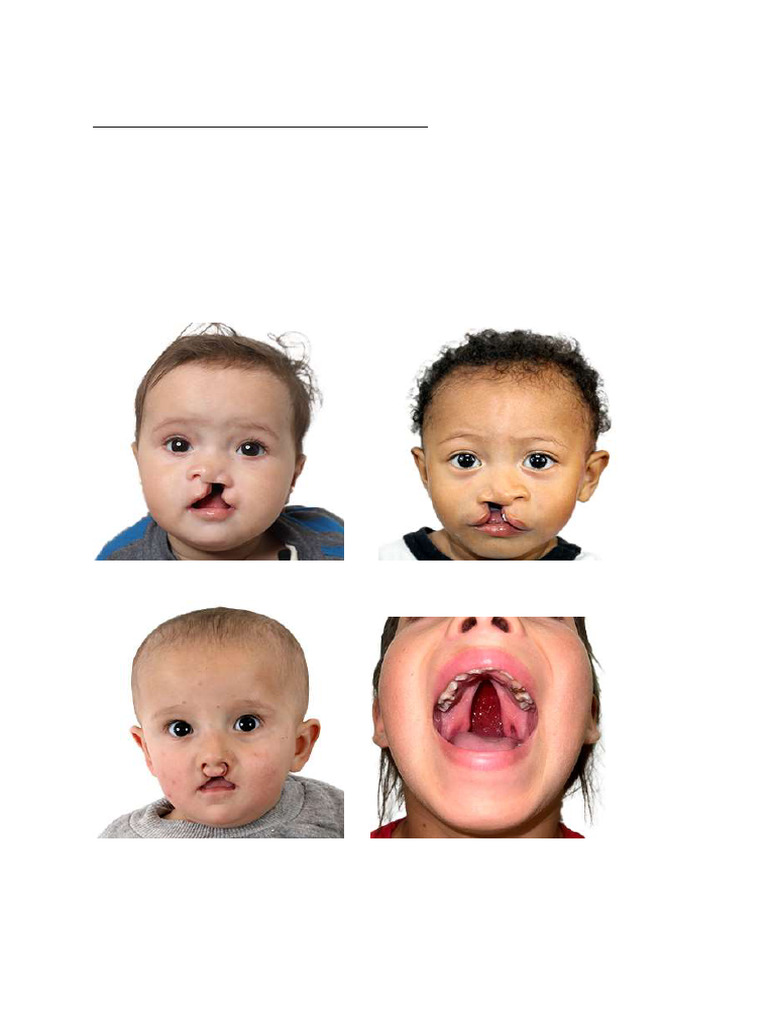 Clinical Manifestation of Congenital Gastrointestinal Diseases | PDF ...