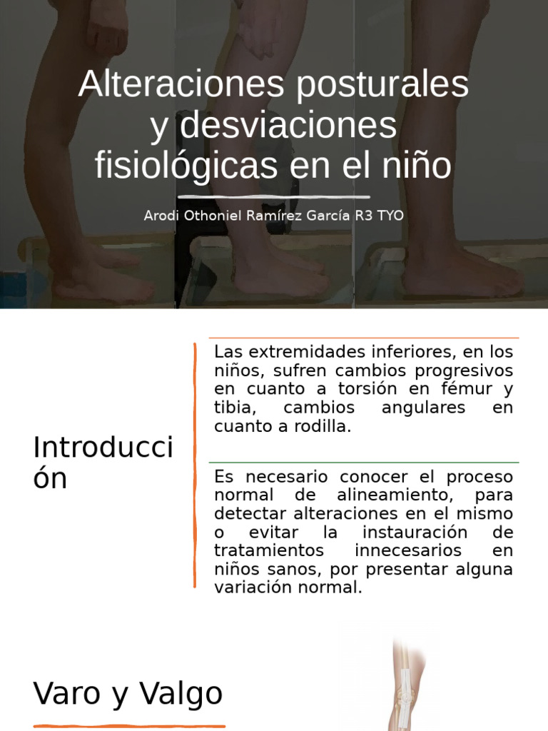 Alteraciones Posturales | PDF | Rodilla | Sistema musculoesquelético
