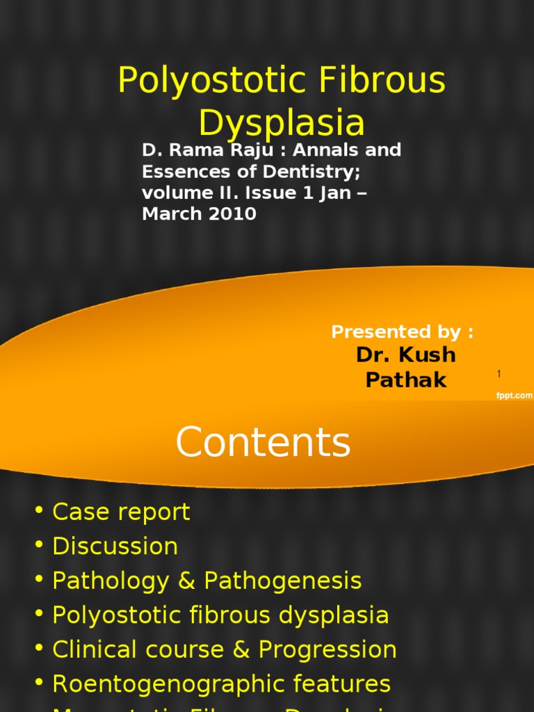 Fibrous Dysplasia - Polyostotic | PDF | Bone | Osteoblast