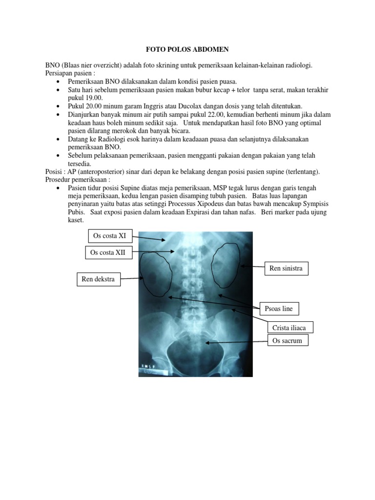 Foto Polos Abdomen | PDF