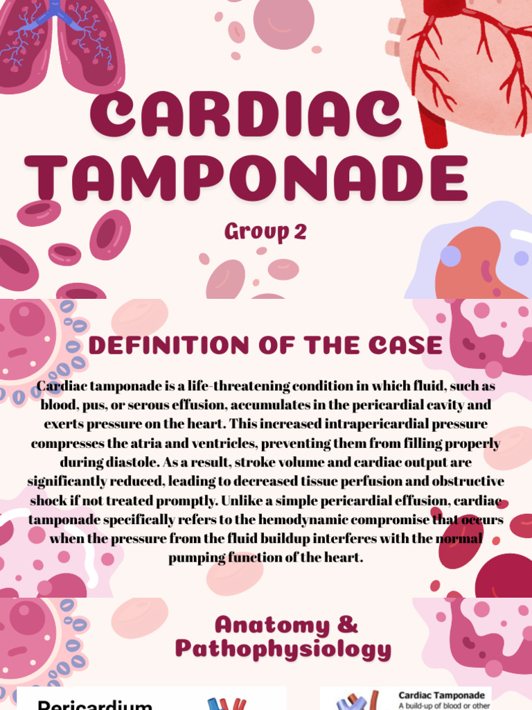 Understanding Cardiac Tamponade Causes | PDF | Heart | Physiology
