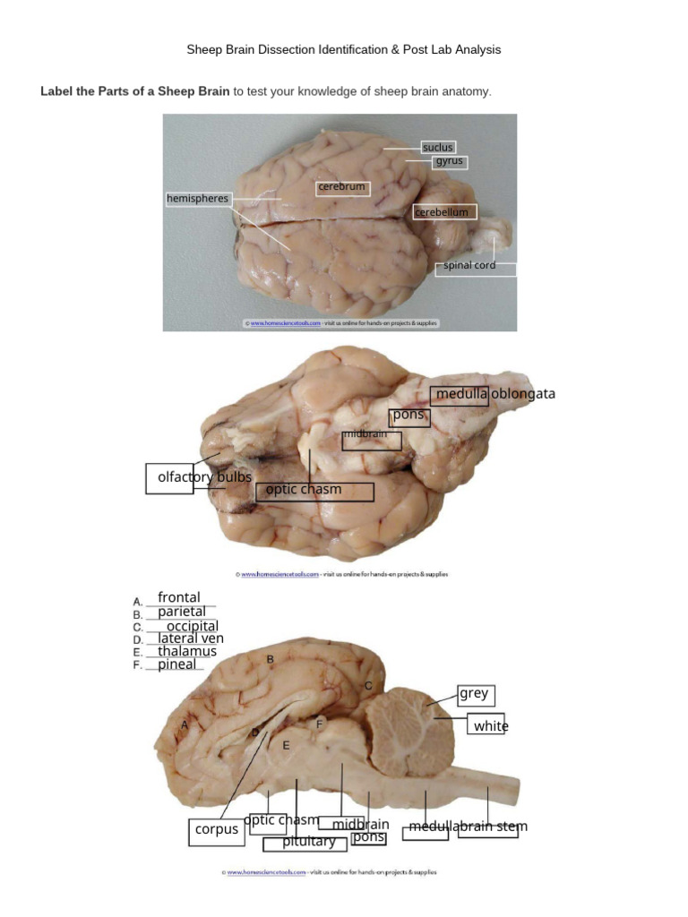 Sheep Brain Dissection Guide | PDF | Cerebrum | Brainstem
