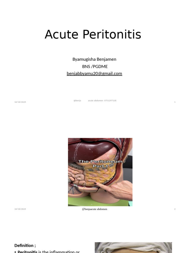 Lect 5 Acute Peritonitis | PDF | Peritoneum | Diseases And Disorders