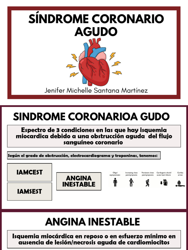 Síndrome Coronario Agudo | PDF | Infarto de miocardio | Isquemia
