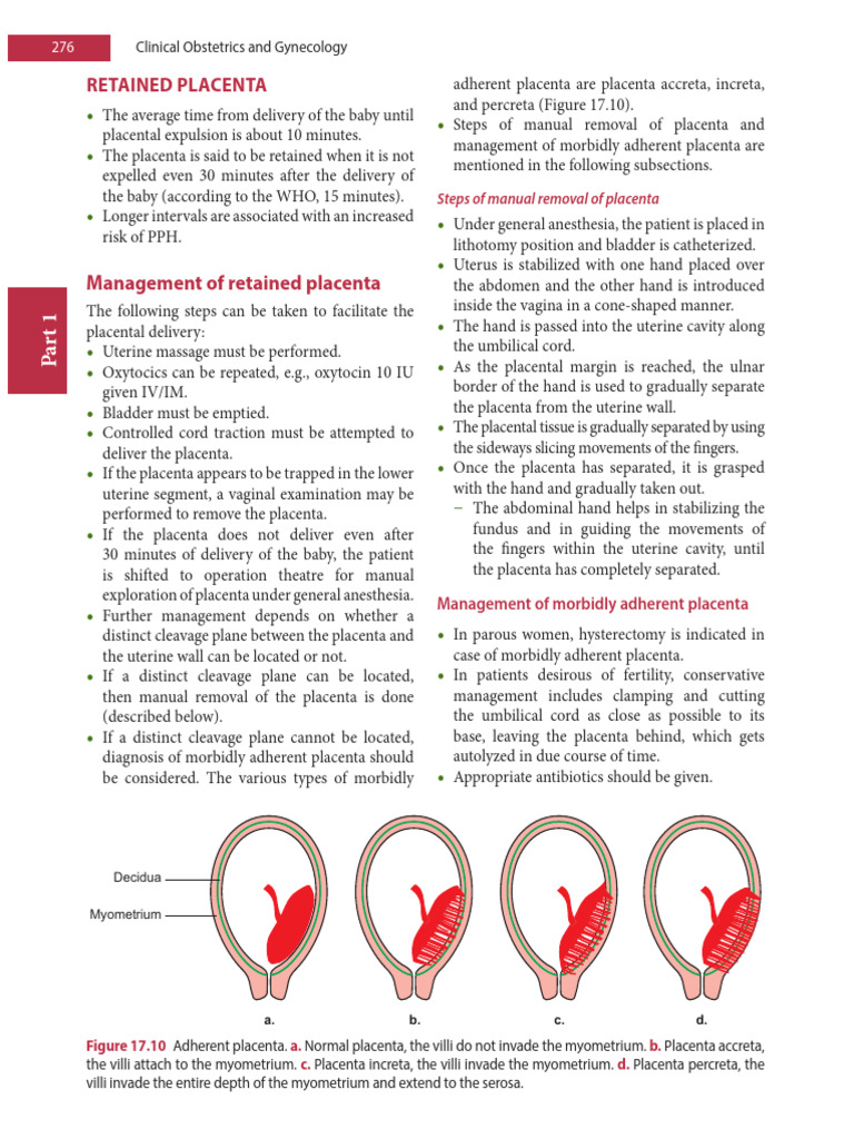 Retained and Morbidly Adherent Placenta | PDF | Mammalian Pregnancy ...