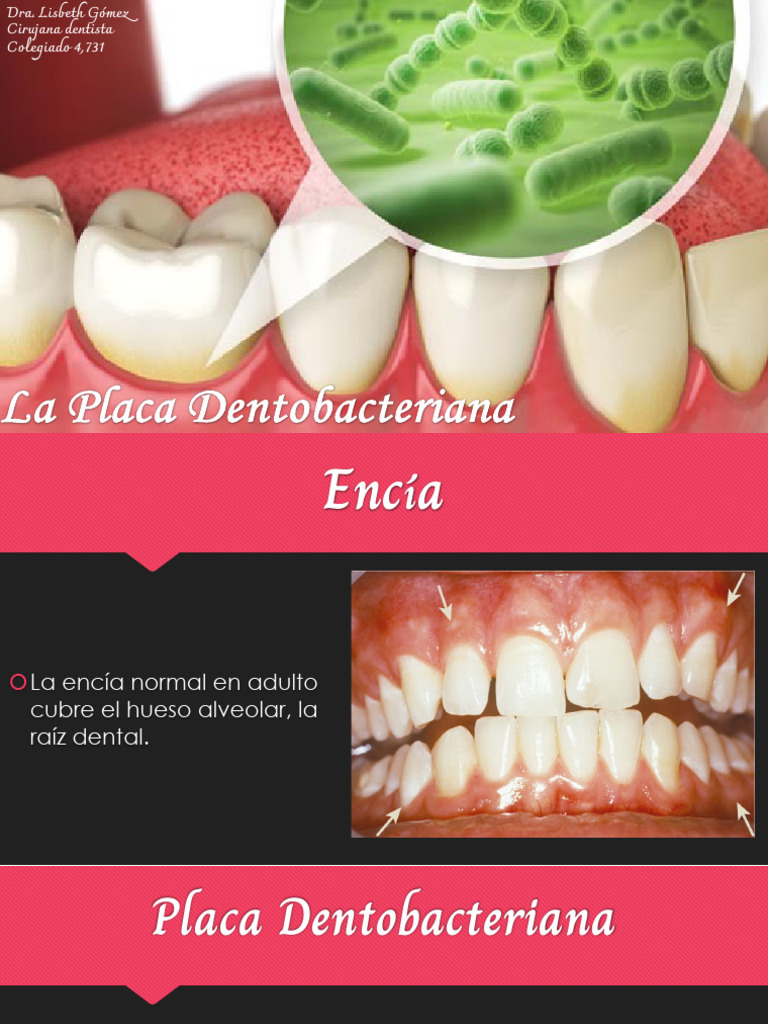 Placa Dentobacteriana y Encías | PDF | Boca