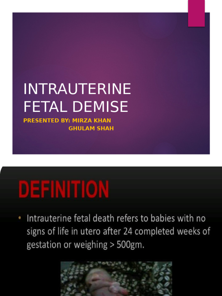 Intrauterine Fetal Demise: Presented By: Mirza Khan Ghulam Shah | PDF