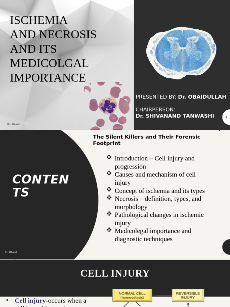 Ischemia and Necrosis | PDF | Ischemia | Myocardial Infarction