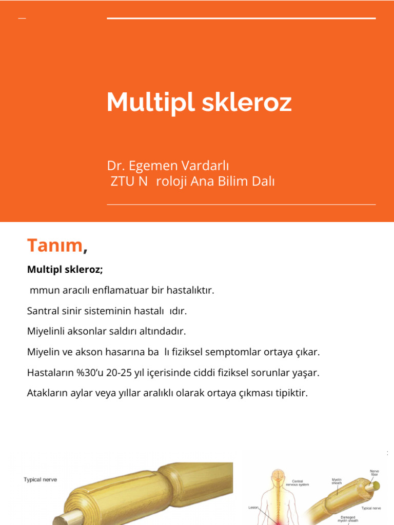 Multipl Skleroz (5. Sınıf) | PDF