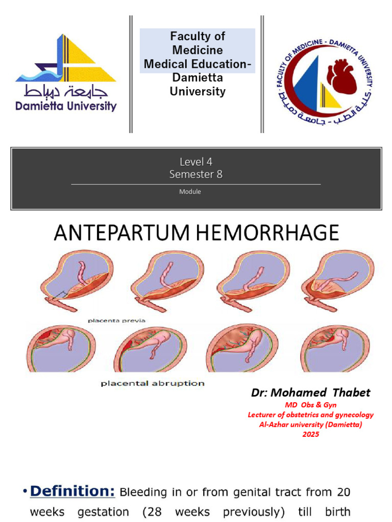 17-18-Antepartum Hge | PDF