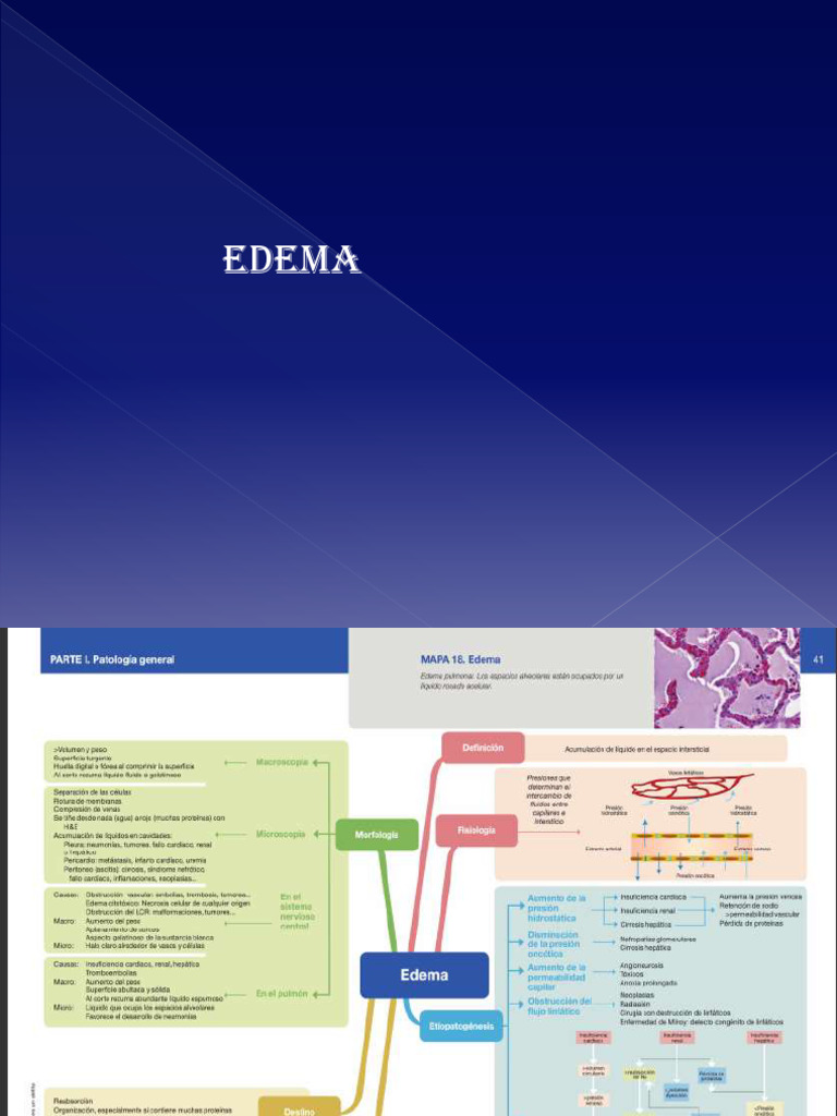 Tipos y Causas del Edema en Salud | PDF | Edema | Especialidades Medicas