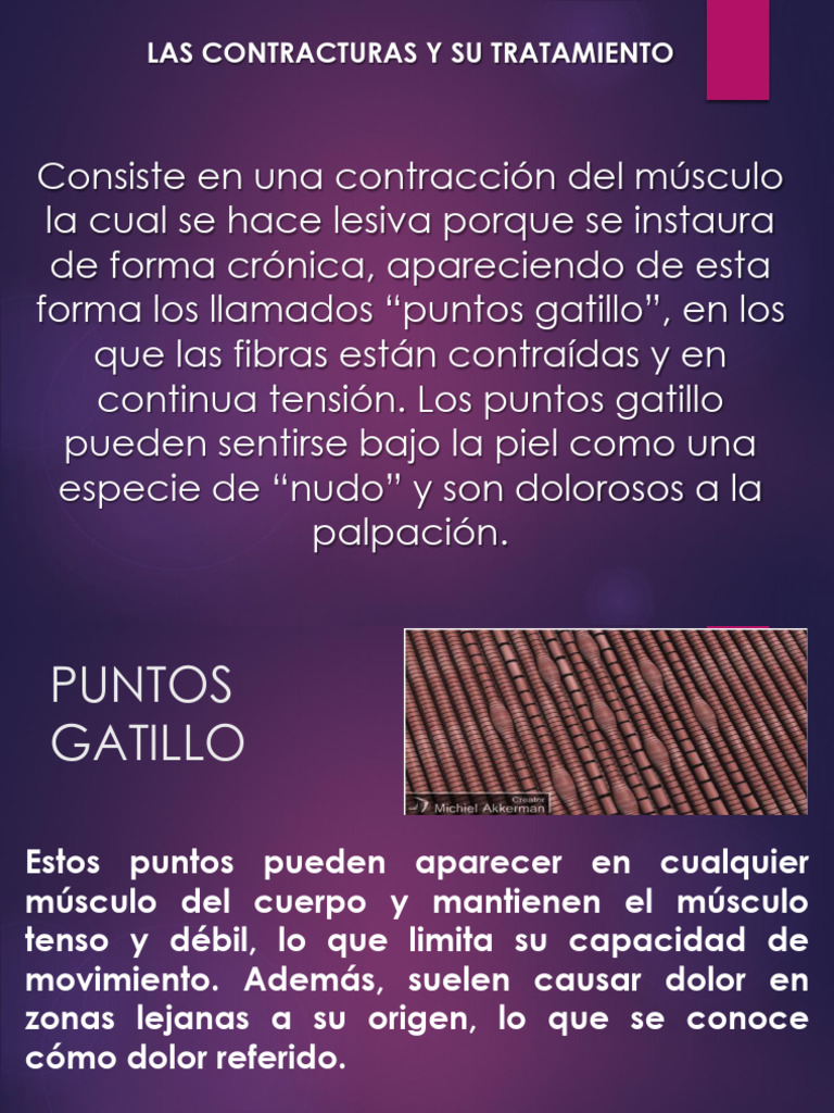 Contracturas Musculares: Causas y Tratamiento | PDF | Punto gatillo ...