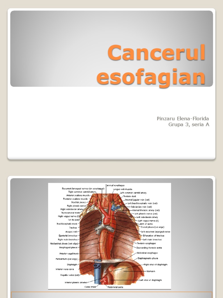 Cancerul Esofagian | PDF