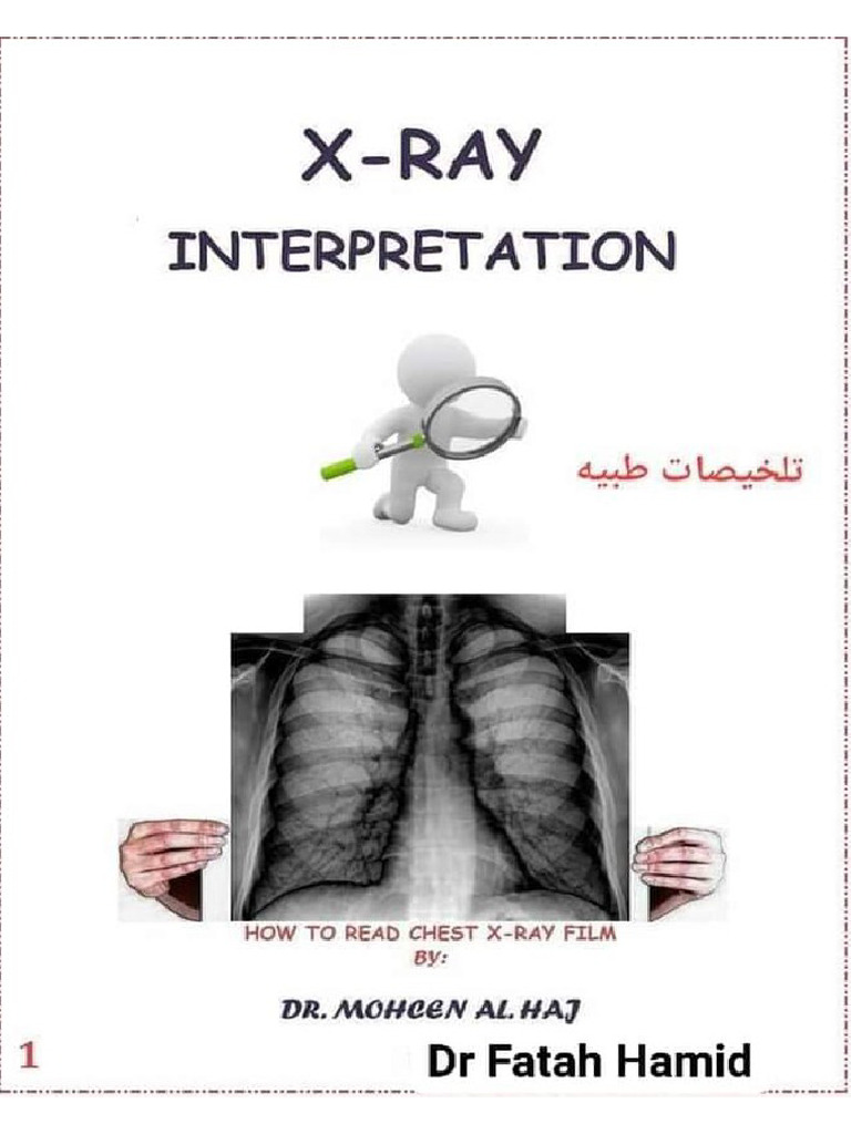 Xray Interpretation | PDF