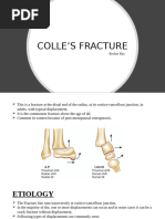 Dinner Fork Deformity in Colles Fractures | PDF | Musculoskeletal ...