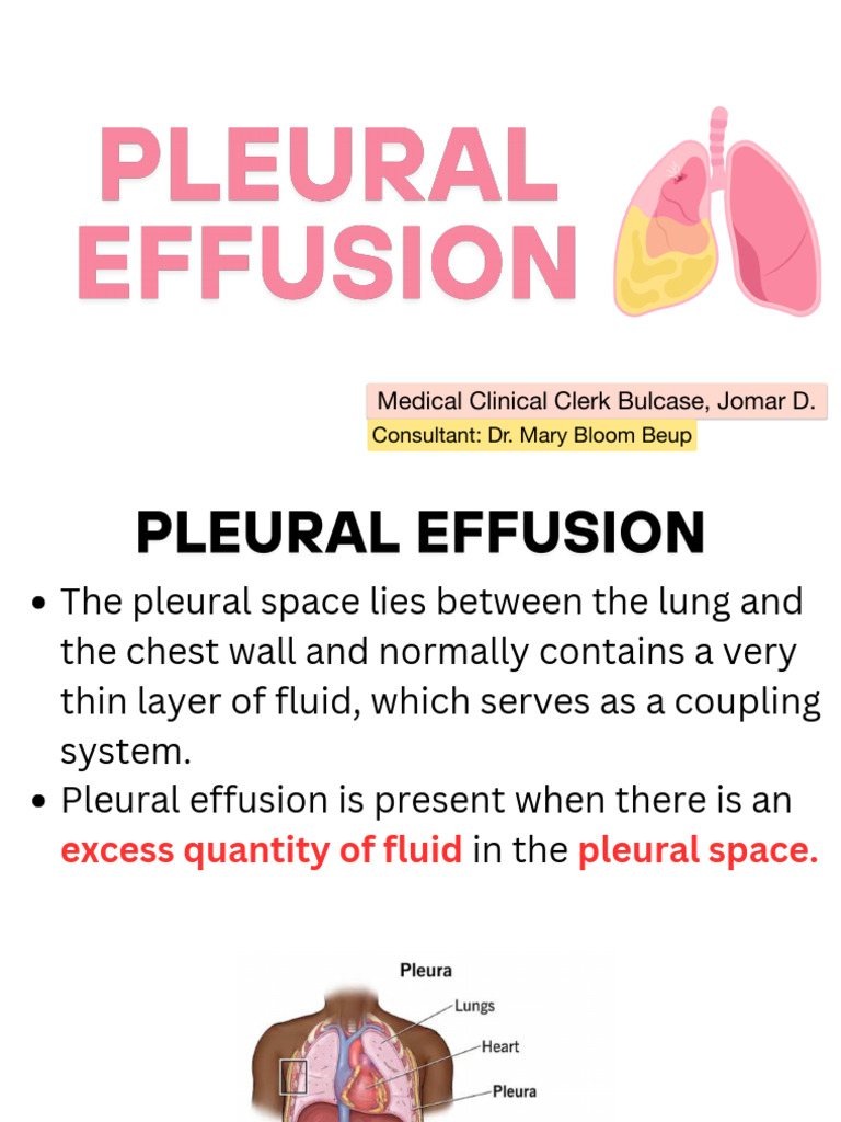 Understanding Pleural Effusion Causes | PDF | Medical Specialties ...