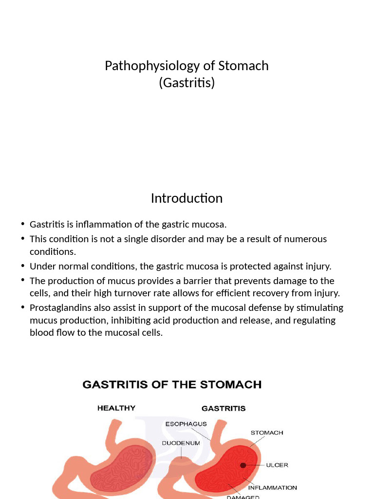 Understanding Gastritis Pathophysiology | PDF