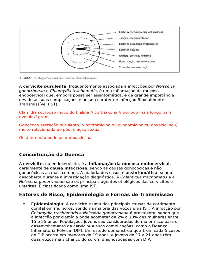 Cervicite Purulenta: Causas e Tratamento | PDF | Infecção sexualmente ...