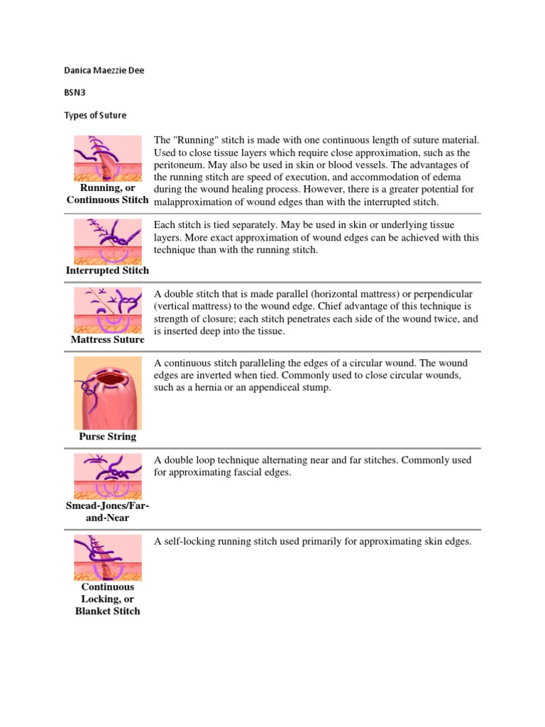 Suture | Surgical Suture | Surgery
