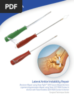 ZipTight Ankle Syndesmosis Technique | PDF | Ankle | Limbs (Anatomy)