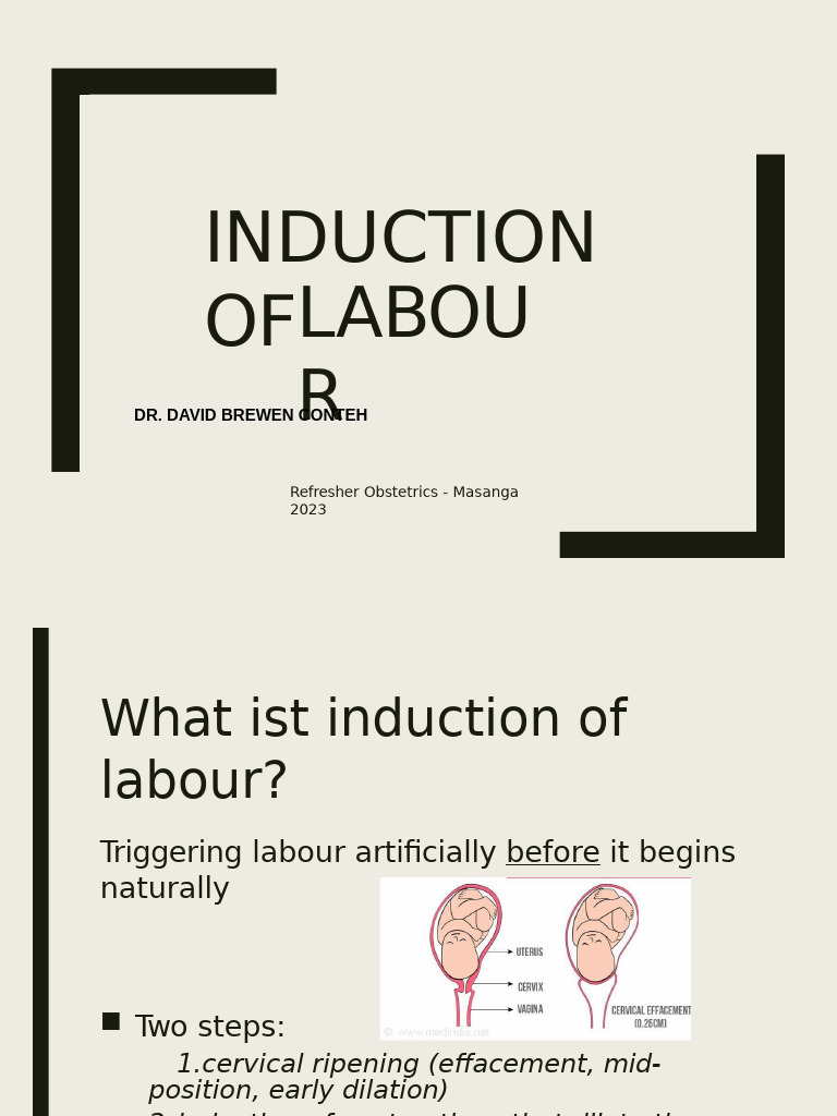 Induction of Labour Guidelines 2023 | PDF | Childbirth | Human Pregnancy