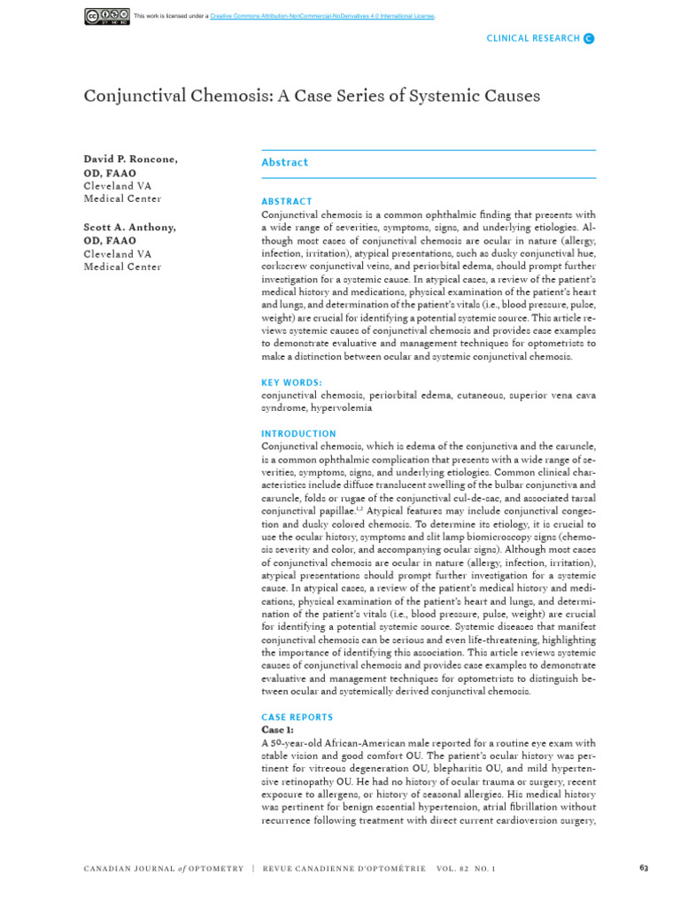 Conjunctival Chemosis A Case Series of Systemic CA | PDF | Thrombosis ...