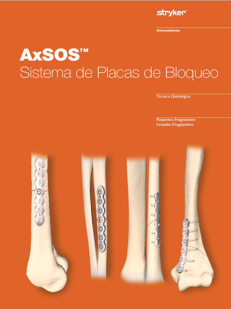 AxSOS Placas Rectas | PDF | Tornillo | Cirugía