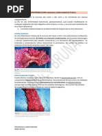 Comparativa: Enfermedad de Crohn vs CUCI | PDF | Colitis ulcerosa ...