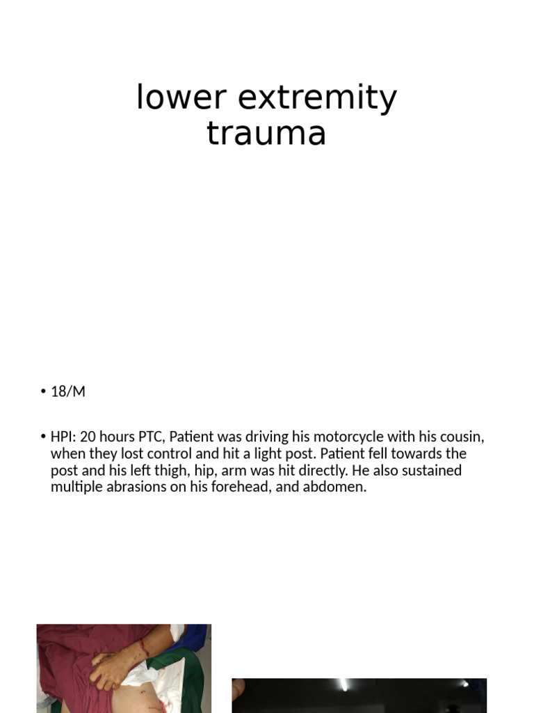 Lower Extremity Trauma | PDF