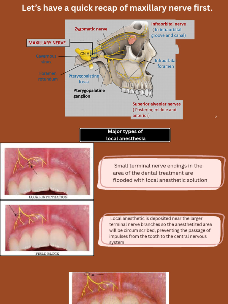 Maxillary Nerve Block Techniques in Dentistry | PDF | Anesthesia ...