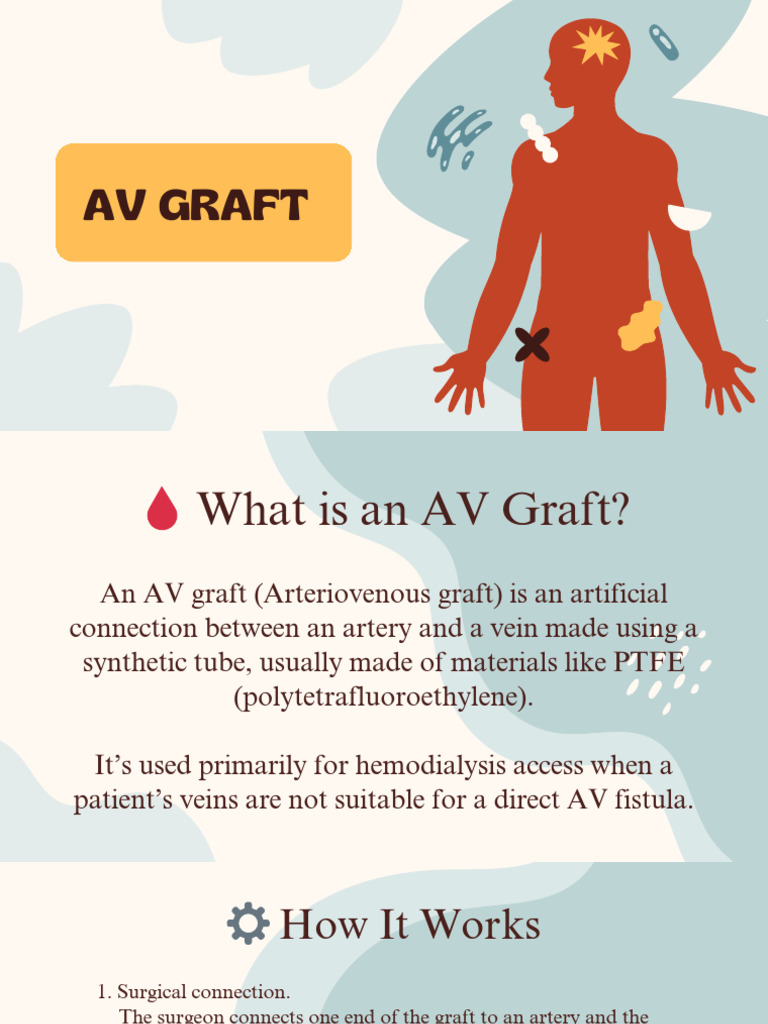 Av Graft - 20251018 - 093551 - 0000 | PDF