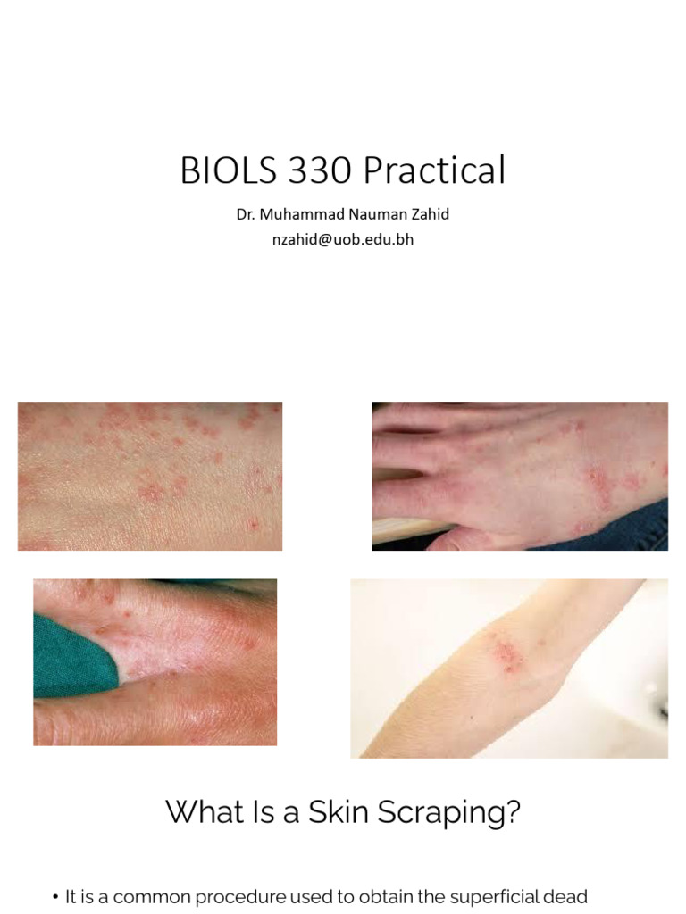 Skin Scraping for Infection Diagnosis | PDF | Diseases And Disorders ...