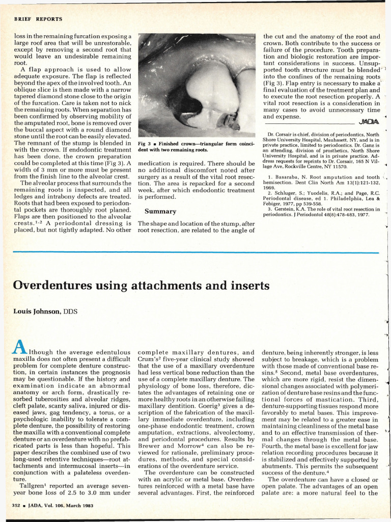 Vital Root Resection Techniques Explained | PDF | Dentures | Dentistry ...
